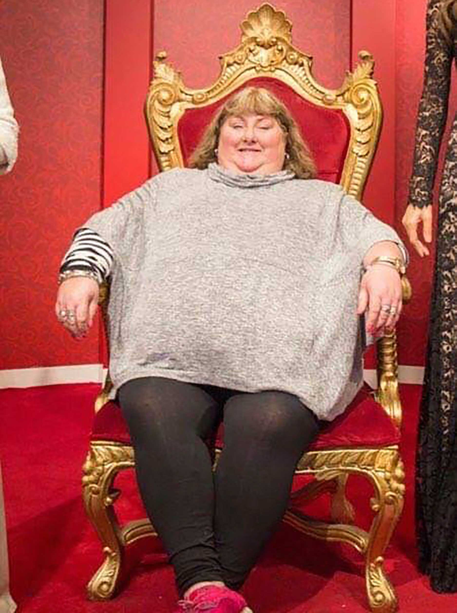 Canterbury mum's 62kg weight loss after being told she wouldn't live ...