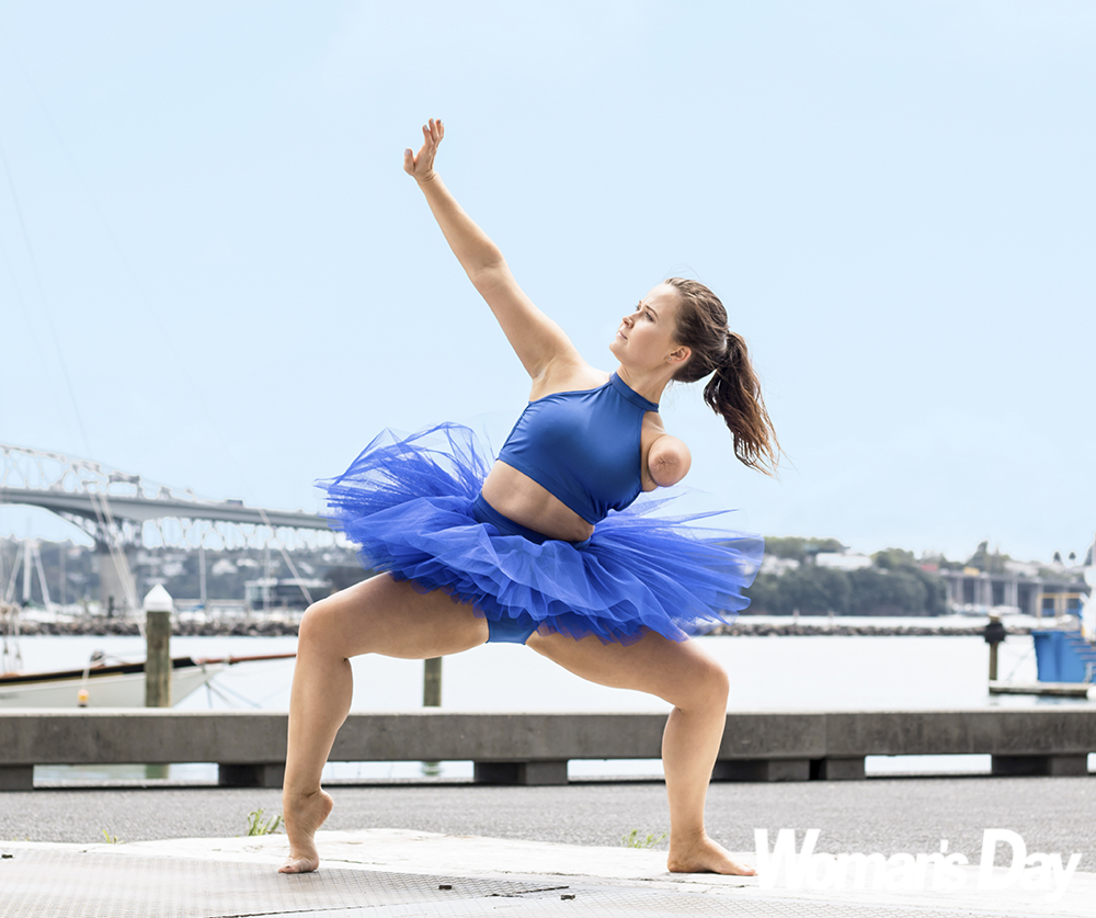One-armed Kiwi dancer Brylee Mills reveals why her disability won't ...